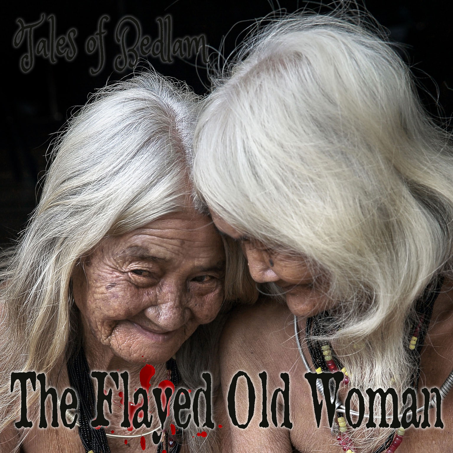 The Flayed Old Woman - Tales of Bedlam